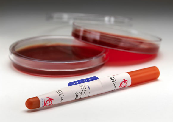 SA Organism Set (Live Culture)